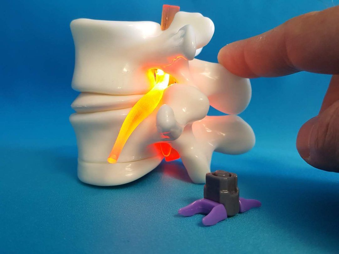 Spine Models - Lumbar, Cervical, Disc Repair - Encoris