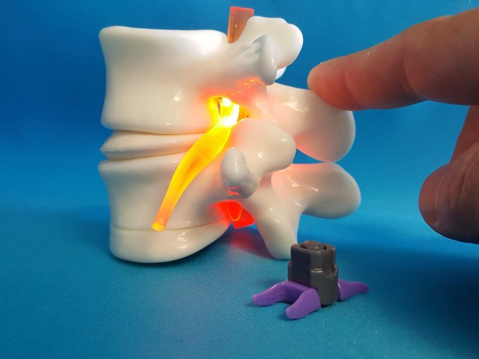 Spine Models - Lumbar, Cervical, Disc Repair - Encoris