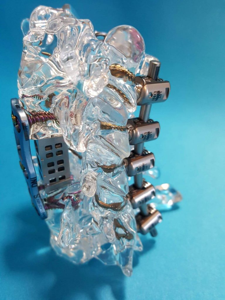 Spine Models - Lumbar, Cervical, Disc Repair - Encoris