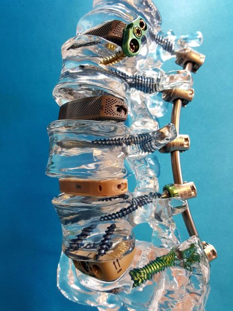 Spine Models - Lumbar, Cervical, Disc Repair - Encoris